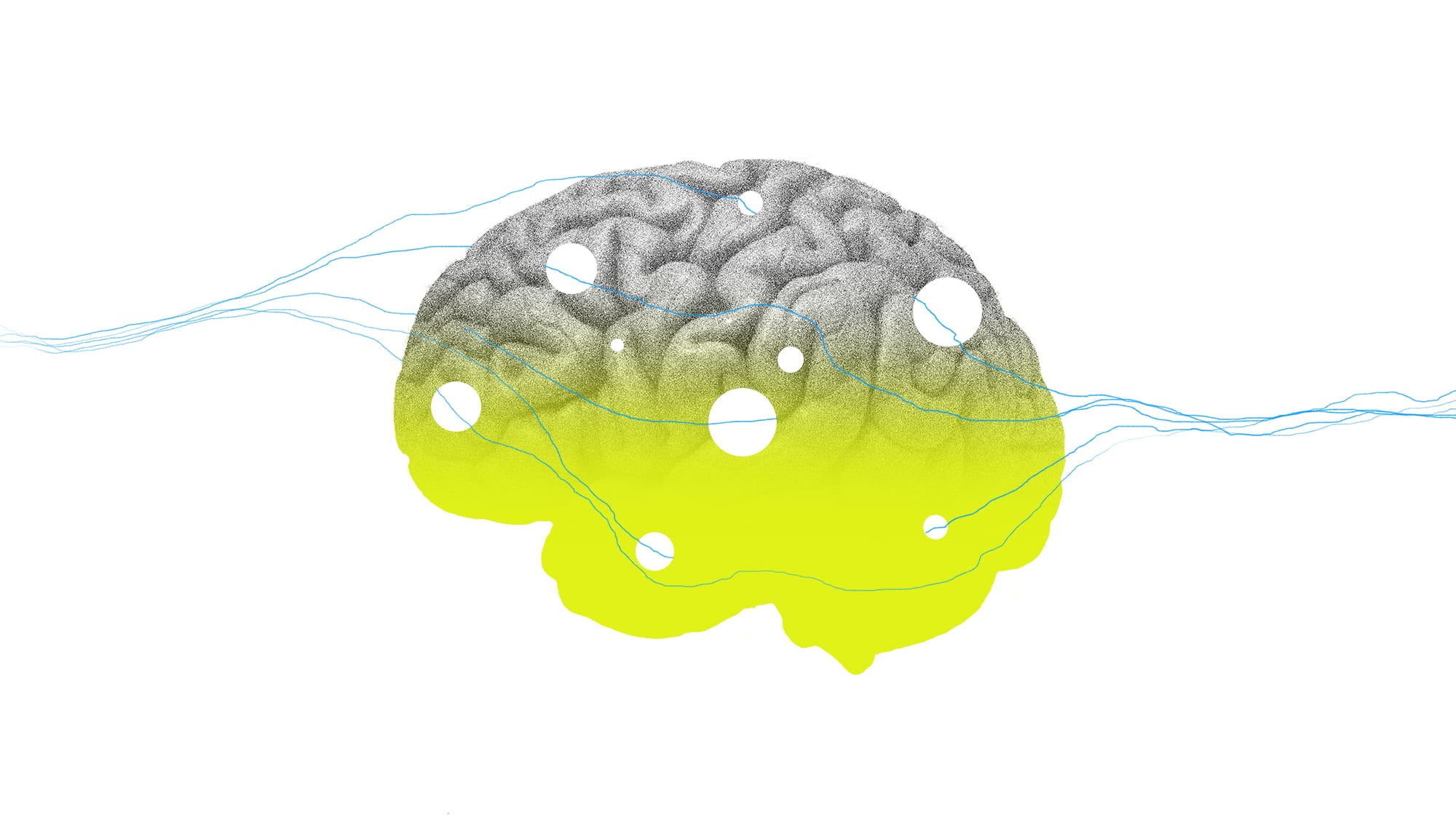 Gray Area: Thinking With a Damaged Brain - Creative Nonfiction